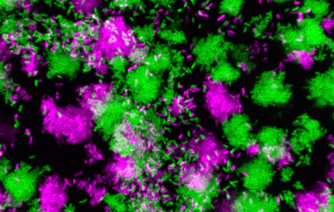 Scientists Discover Small RNA That Regulates Bacterial Infection